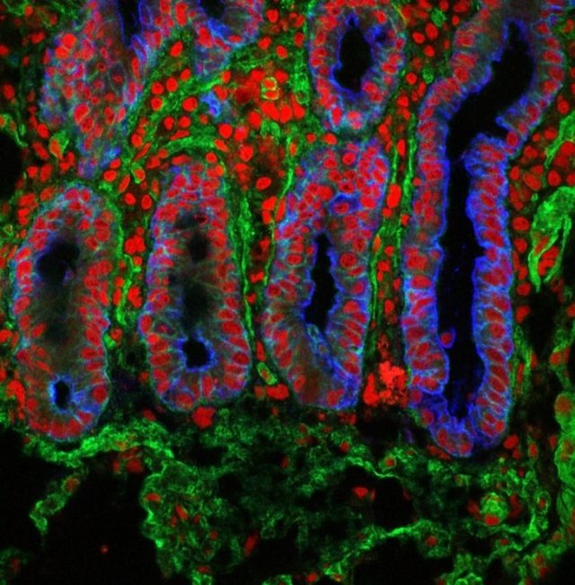 Voici à quoi ressemblent nos organes au microscope - ipnoze