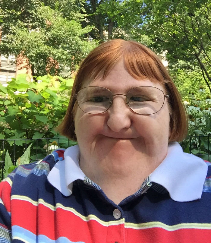 Des Trolls Ont Dit à Cette Femme Quelle était « Trop Laide Pour