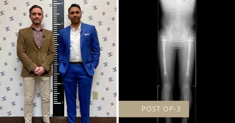 Ce médecin dit qu’il peut ajouter jusqu’à 15 cm à la taille des gens ...