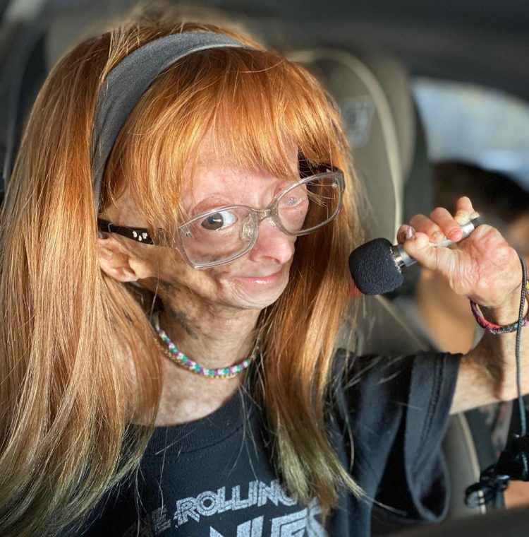 La star des médias sociaux Adalia Rose Williams est morte à l’âge de 15 ans