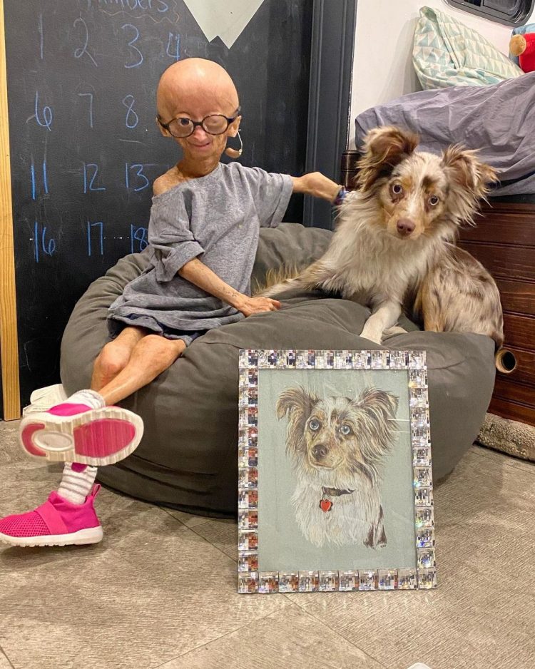 La star des médias sociaux Adalia Rose Williams est morte à l’âge de 15 ...