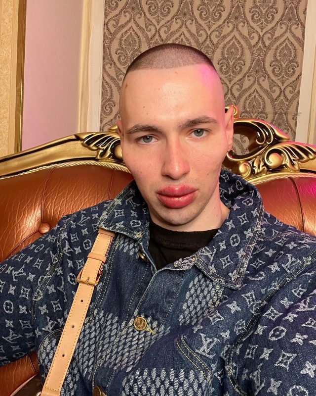 Le Popeye russe ignore les avertissements des médecins et se fait ...