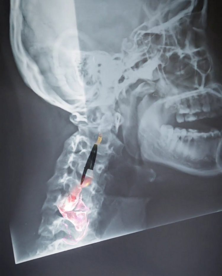 Les gens commencent tout juste à comprendre pourquoi il y a un trou ...