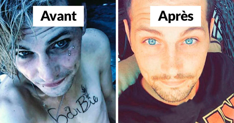 33 transformations hallucinantes de personnes qui ont arrêté la drogue ...