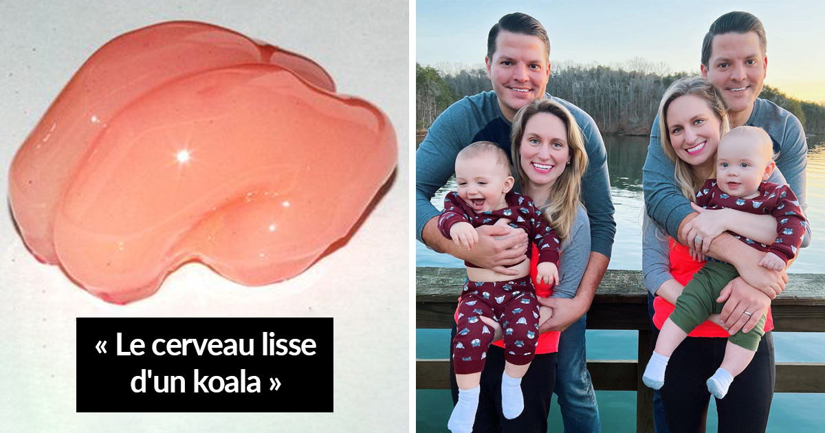 Ces images sont étranges et curieusement effrayantes - ipnoze